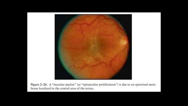 Tractional RD | PPTX