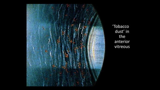 Tractional RD | PPTX