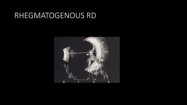 Tractional RD | PPTX