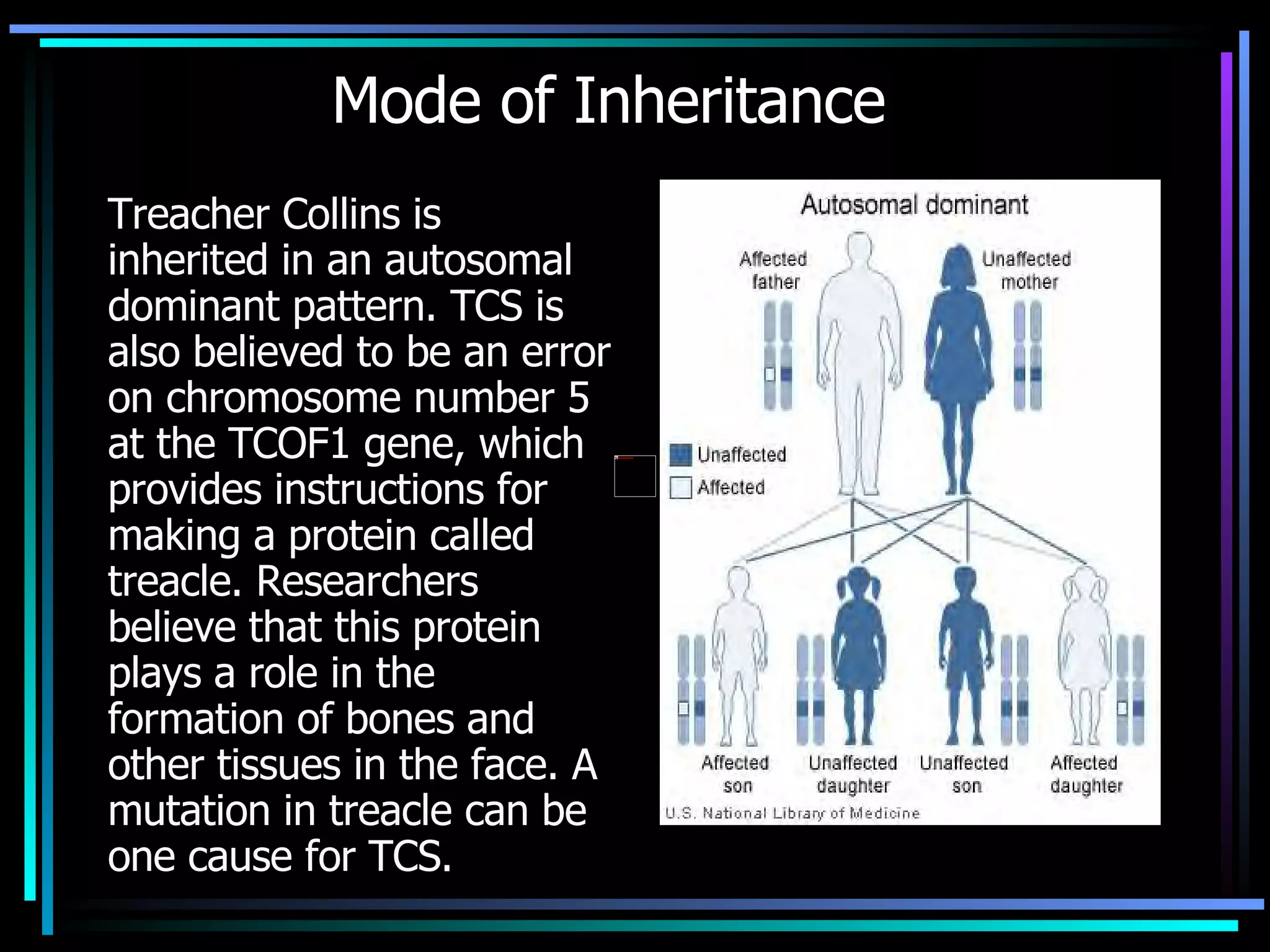 Treacher Collins | PPT