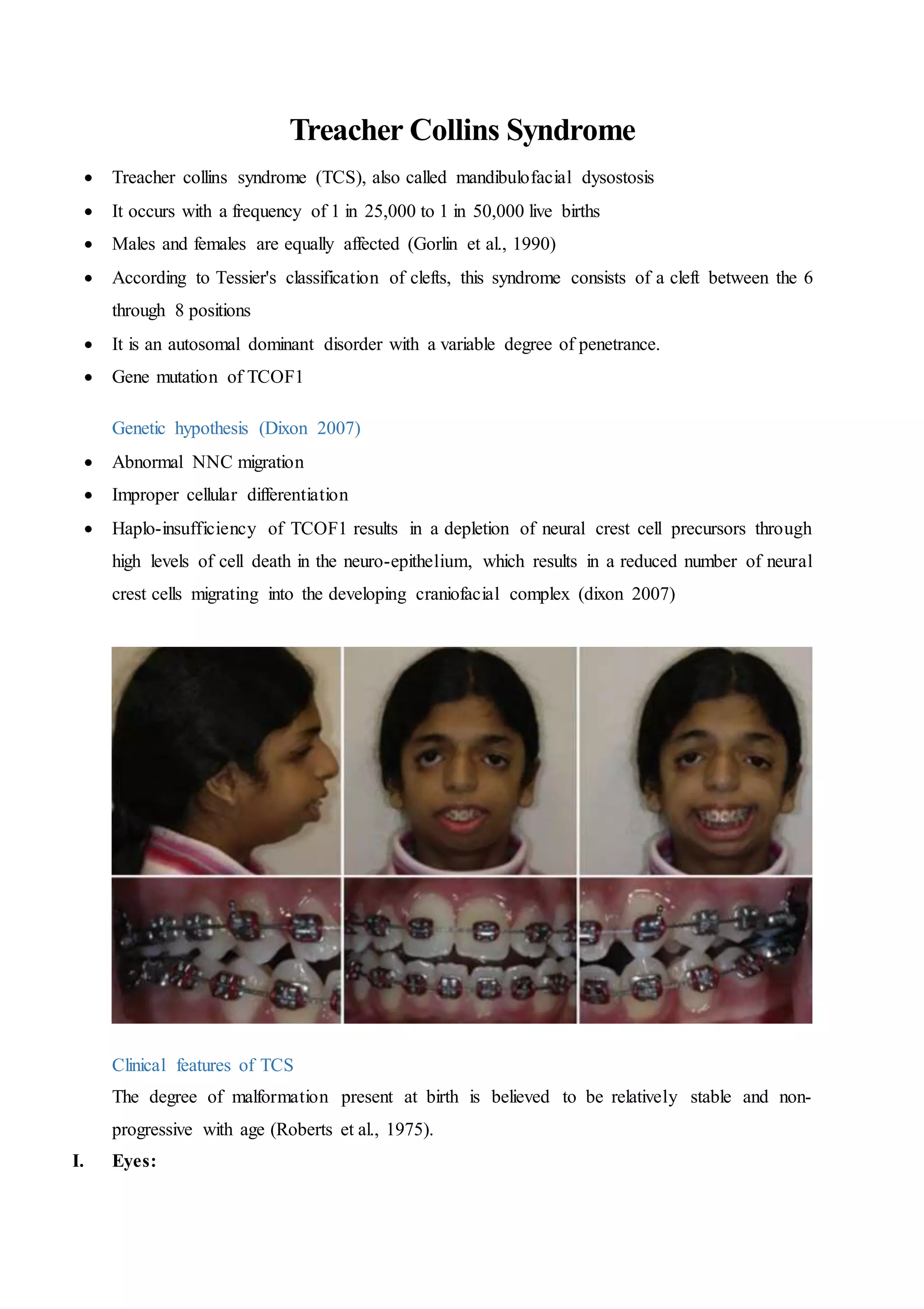 Treacher collins syndrome for orthodontist by almuzian | DOCX