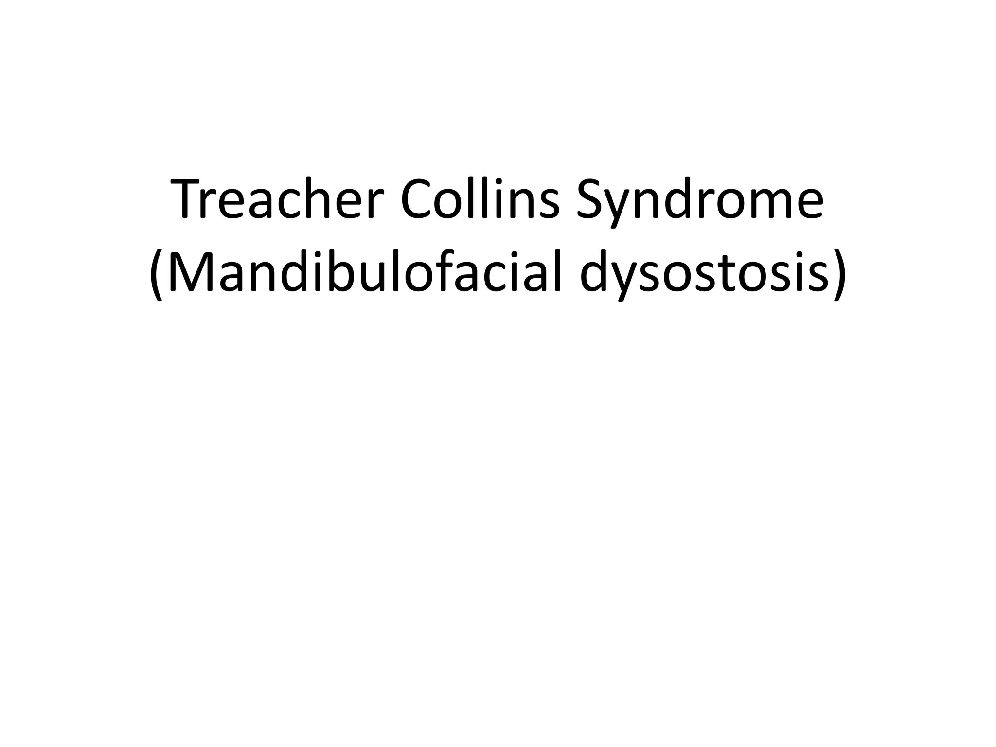 Treacher colllin syndrome | PPTX