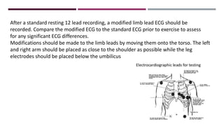 Treadmill Test.pptx