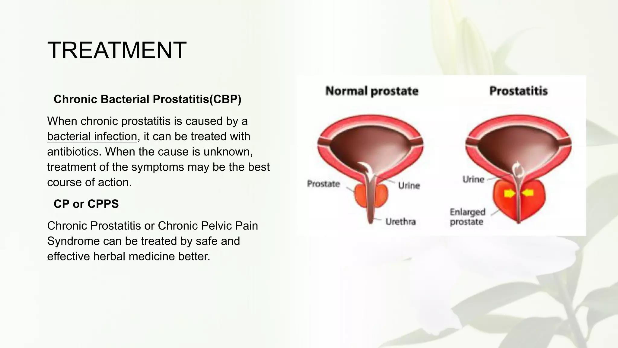 Treat chronic prostatitis by herbal medicine | PDF