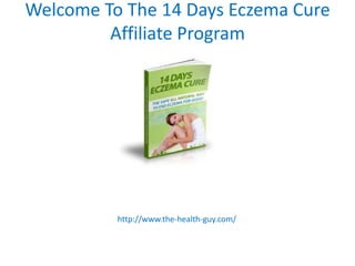Treat eczema | PPT