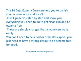 Treat eczema | PPT