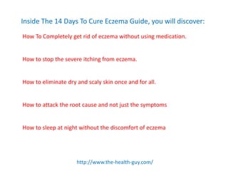 Treat eczema | PPT