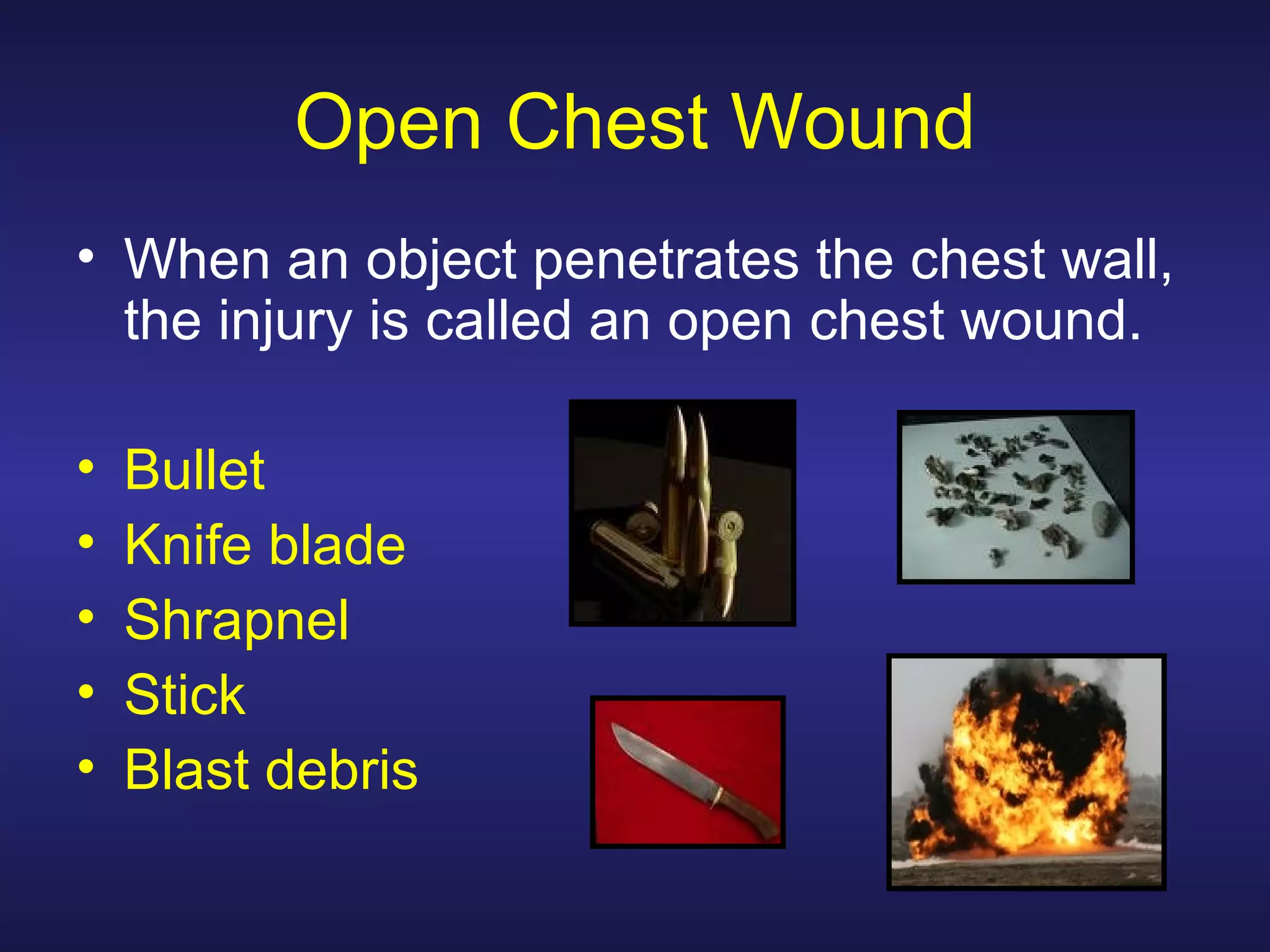 Treating Penetrating Chest Trauma | PPT
