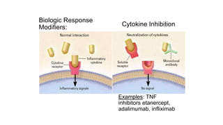Treating new and refractory SJIA patients - Jennifer Huggins | PPT