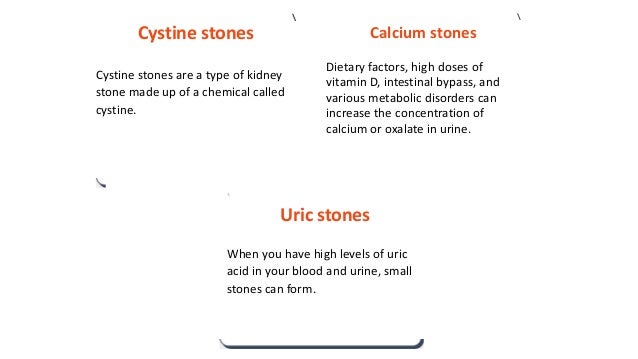 Treatment-And-Prevention-of-kidney-stone.ppt | Chemistry | Science