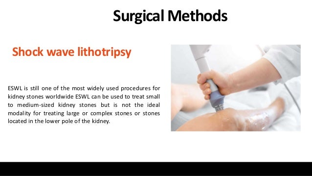Treatment-And-Prevention-of-kidney-stone.ppt