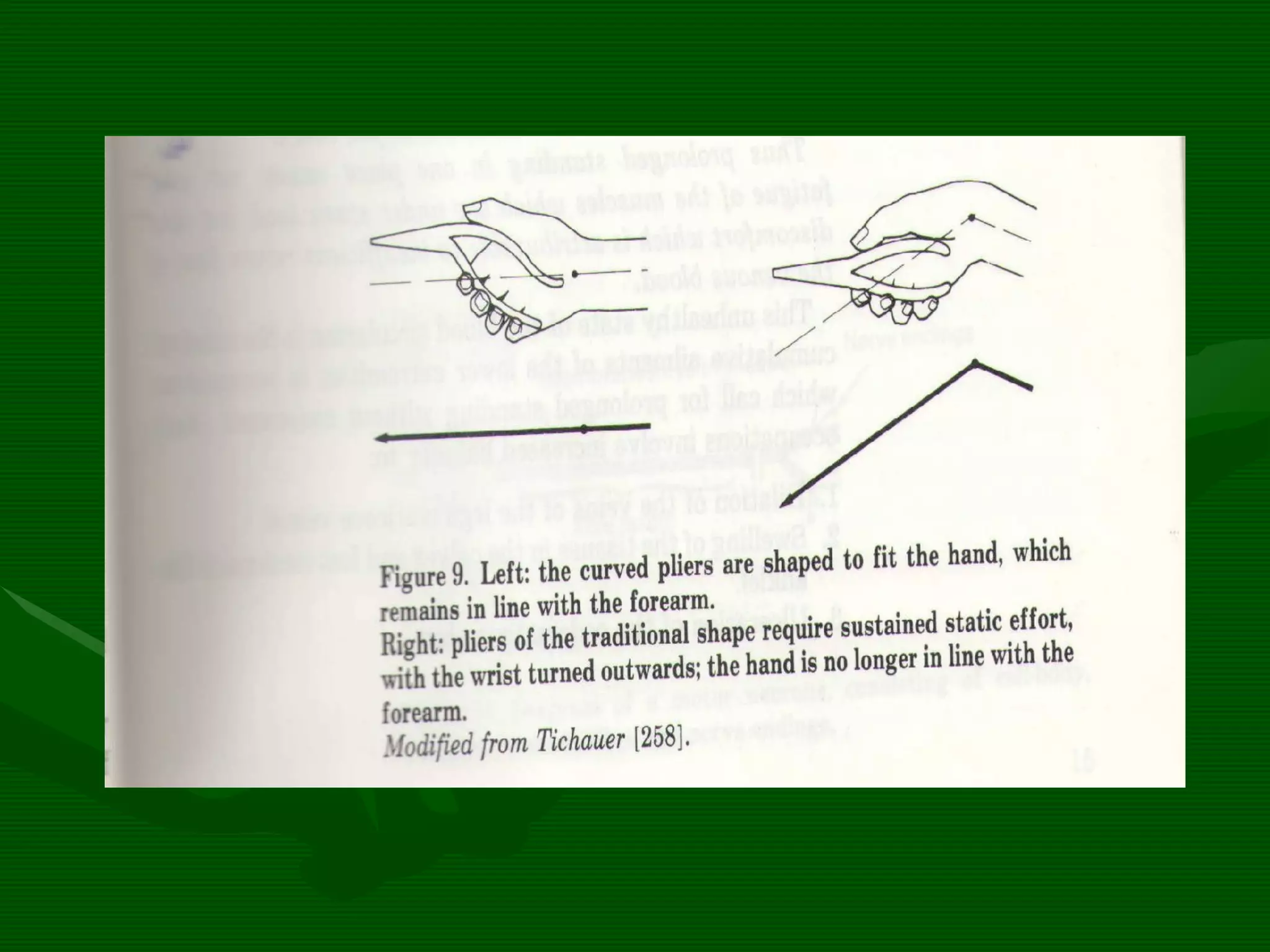 Hand Therapy - Treatment Modalities Of The Wrist | PPT