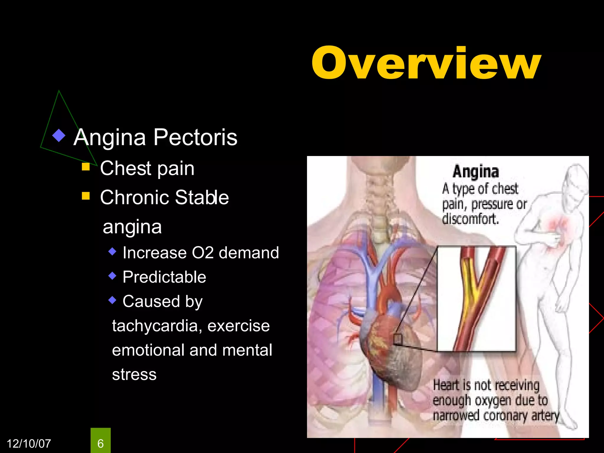 Treatment Options For The Chronic Stable Angina | PPT