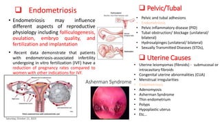 Treatment and causes of female infertility.pptx