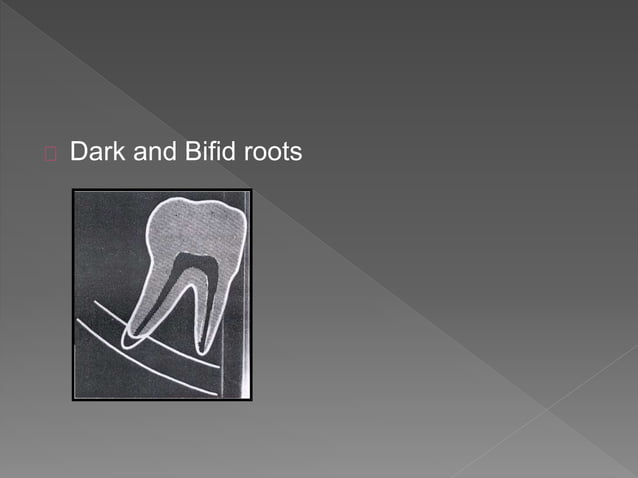 Treatment and complications of impactions | PPTX | Dental Health ...