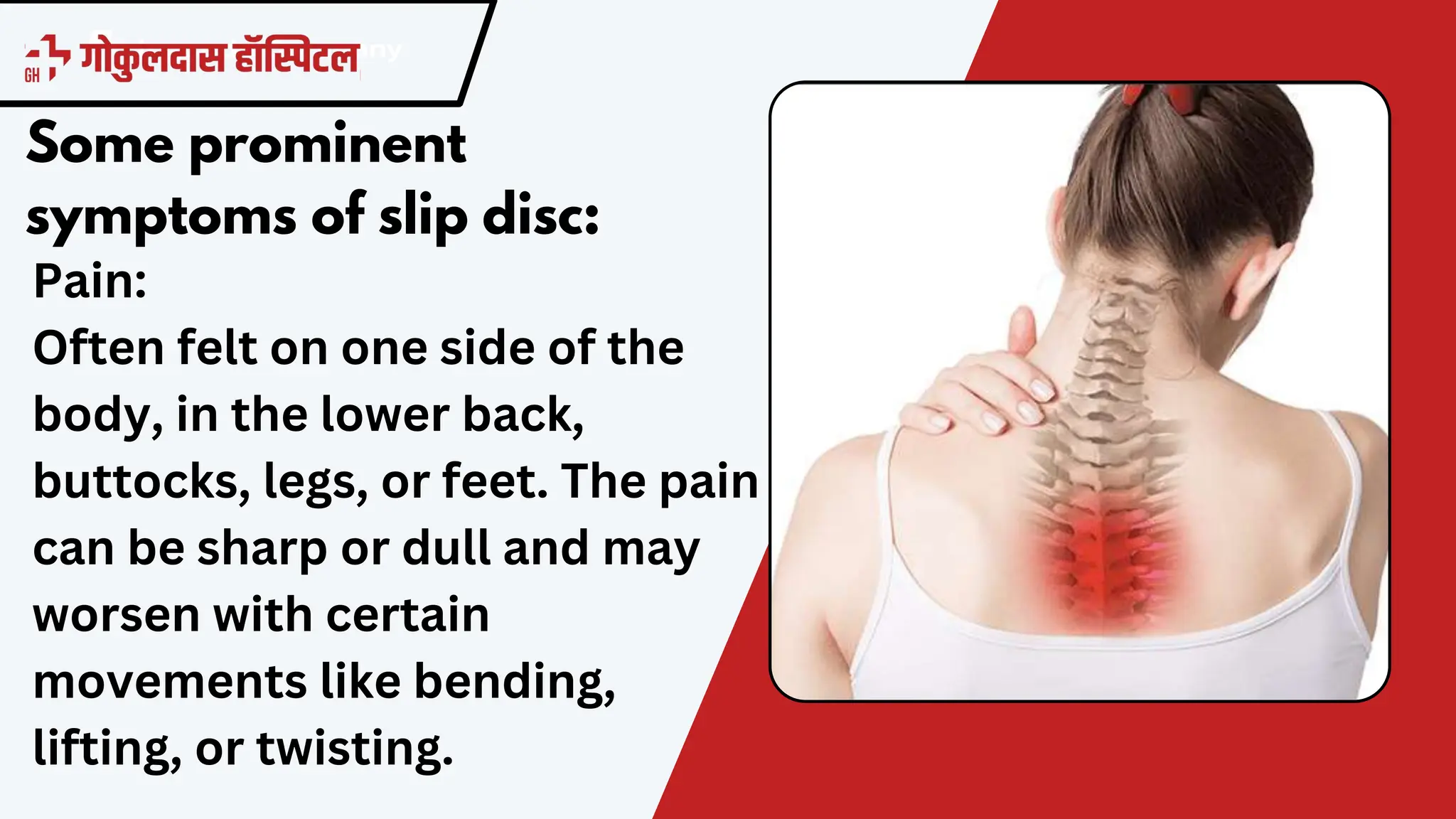 Treatment Choices for Slip Disc at Gokuldas Hospital | PPTX