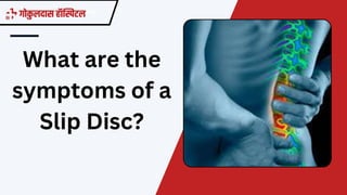 Treatment Choices for Slip Disc at Gokuldas Hospital | PPTX