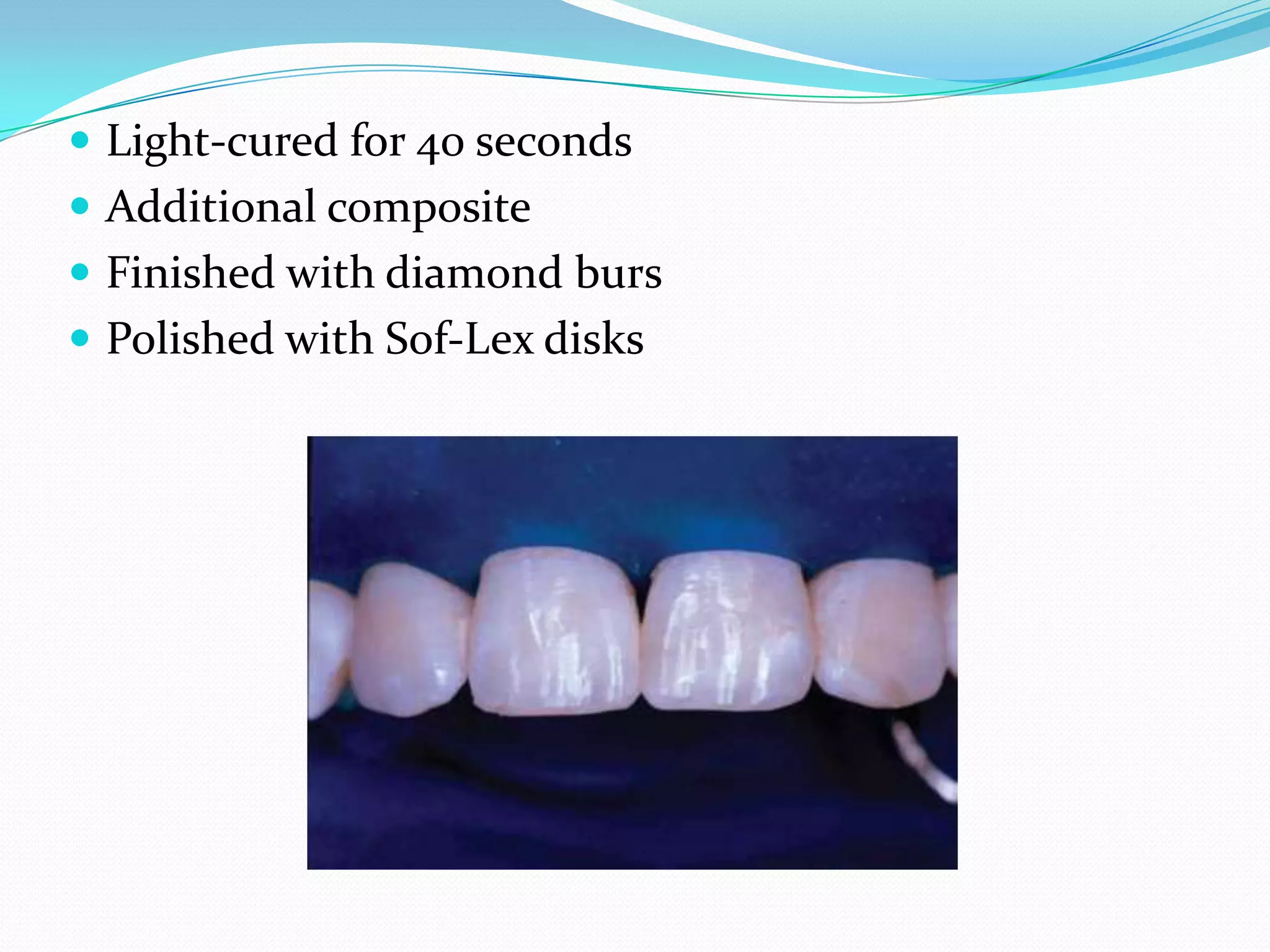 Treatment crown fracture | PPTX