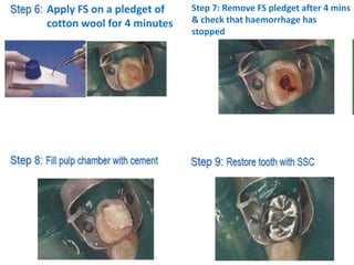 Treatment crown fracture | PPTX