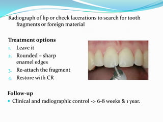 Treatment crown fracture | PPTX