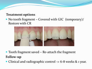 Treatment crown fracture | PPTX