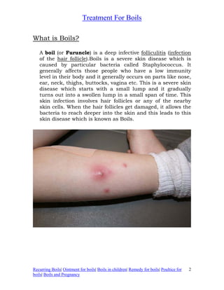 Yeast Infection Boils