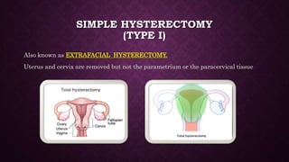 Treatment for Carcinoma Cervix | PPT