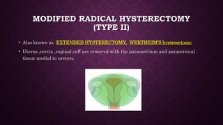 Treatment for Carcinoma Cervix | PPT