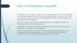 Treatment for Chickenpox - DOC-AID Urgent Care.pdf