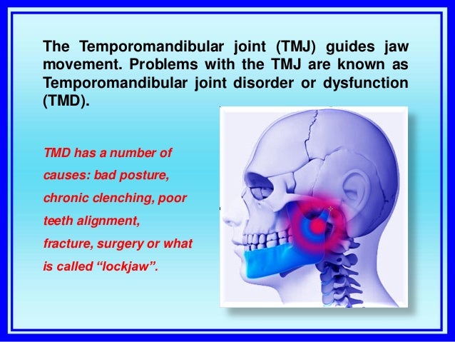 Understanding Treatment For Temporomandibular Joint Disorder Doc