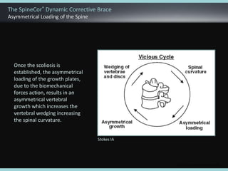 Treatment goal spine cor brace 5 01-2013 | PPT