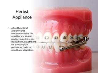 treatment in ortho dentistry university .pptx