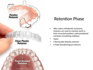 treatment in ortho dentistry university .pptx