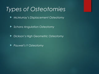 Treatment modality of non union fracture neck of femur | PPT