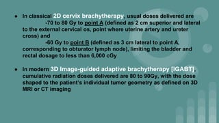 Treatment of Advanced stage of Carcinoma Cervix & Ca cervix in ...