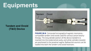 Treatment of Advanced stage of Carcinoma Cervix & Ca cervix in ...
