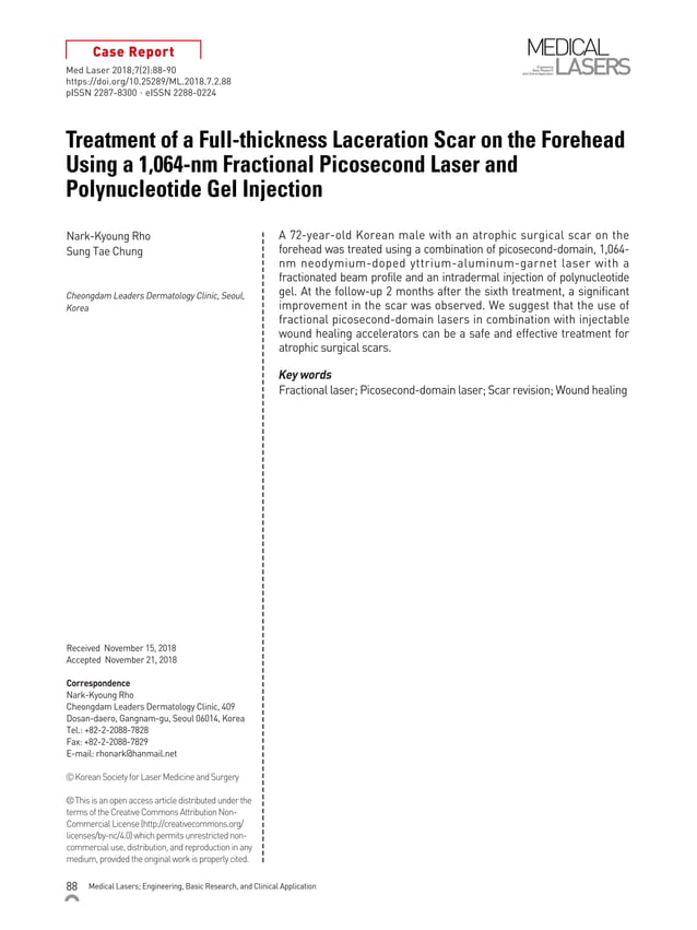 Treatment of a Full-thickness Laceration Scar on the Forehead Using a ...