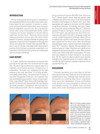 Treatment of a Full-thickness Laceration Scar on the Forehead Using a ...