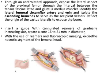 Treatment of avn of femoral head | PPTX