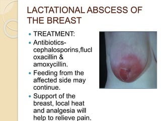 Treatment of benign breast diseases | PPTX