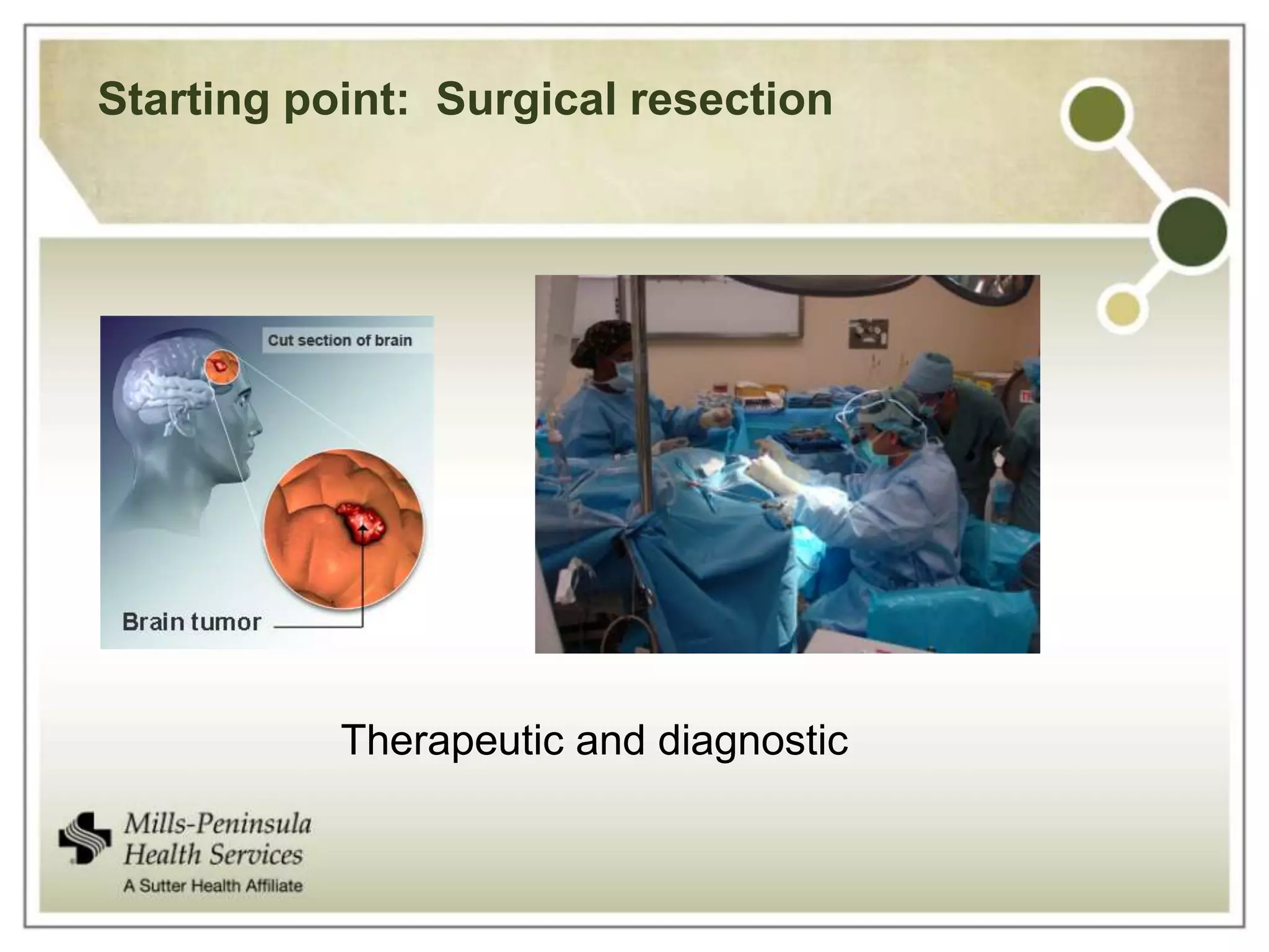 Treatment of brain malignancies and other brain lesions: Emergence of stereotactic radiosurgery ...