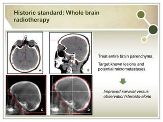 Treatment of brain malignancies and other brain lesions: Emergence of ...