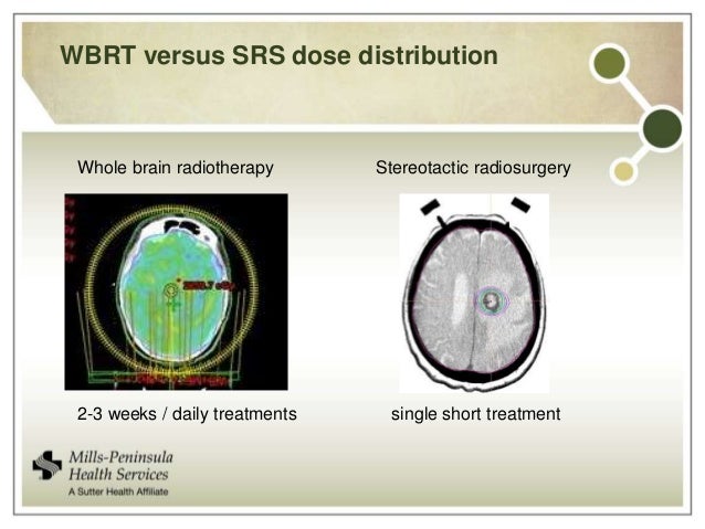 Treatment of brain malignancies and other brain lesions: Emergence o…