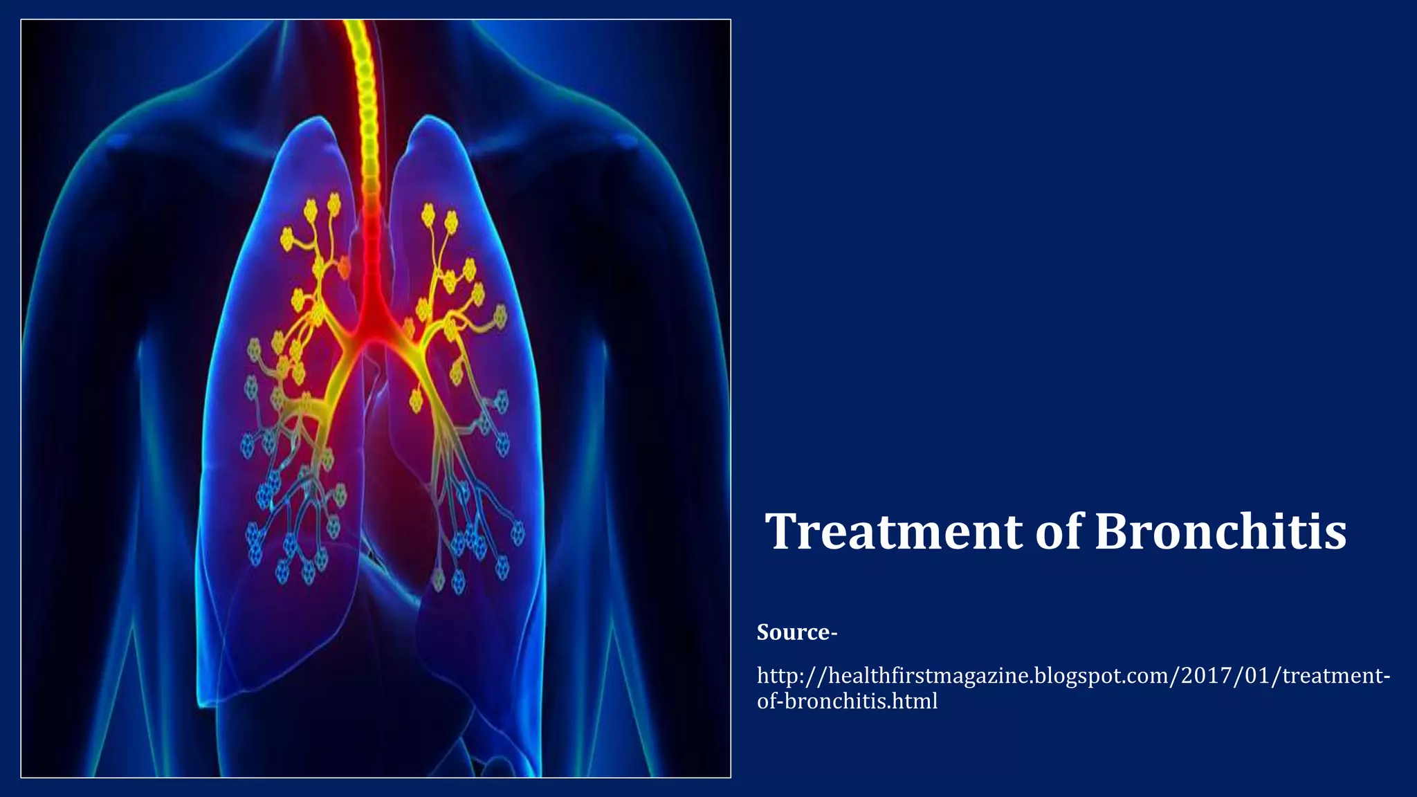 Treatment of bronchitis | PPT