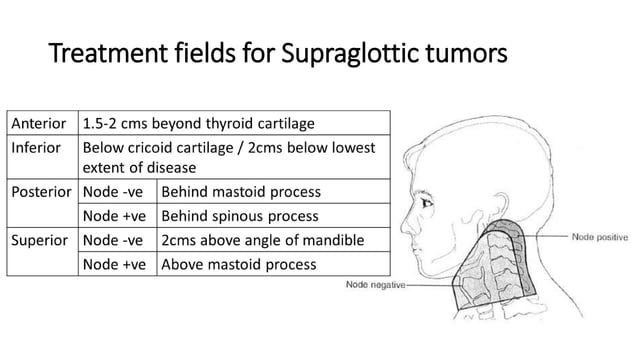 Treatment of carcinoma larynx | PPT