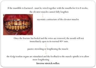 Treatment of Chronic Mandibular Hypomobility and Growth Disorders.pptx