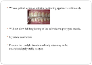 Treatment of Chronic Mandibular Hypomobility and Growth Disorders.pptx