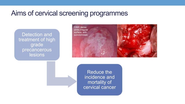 Treatment of cin2 and persisten c in1 | PPTX