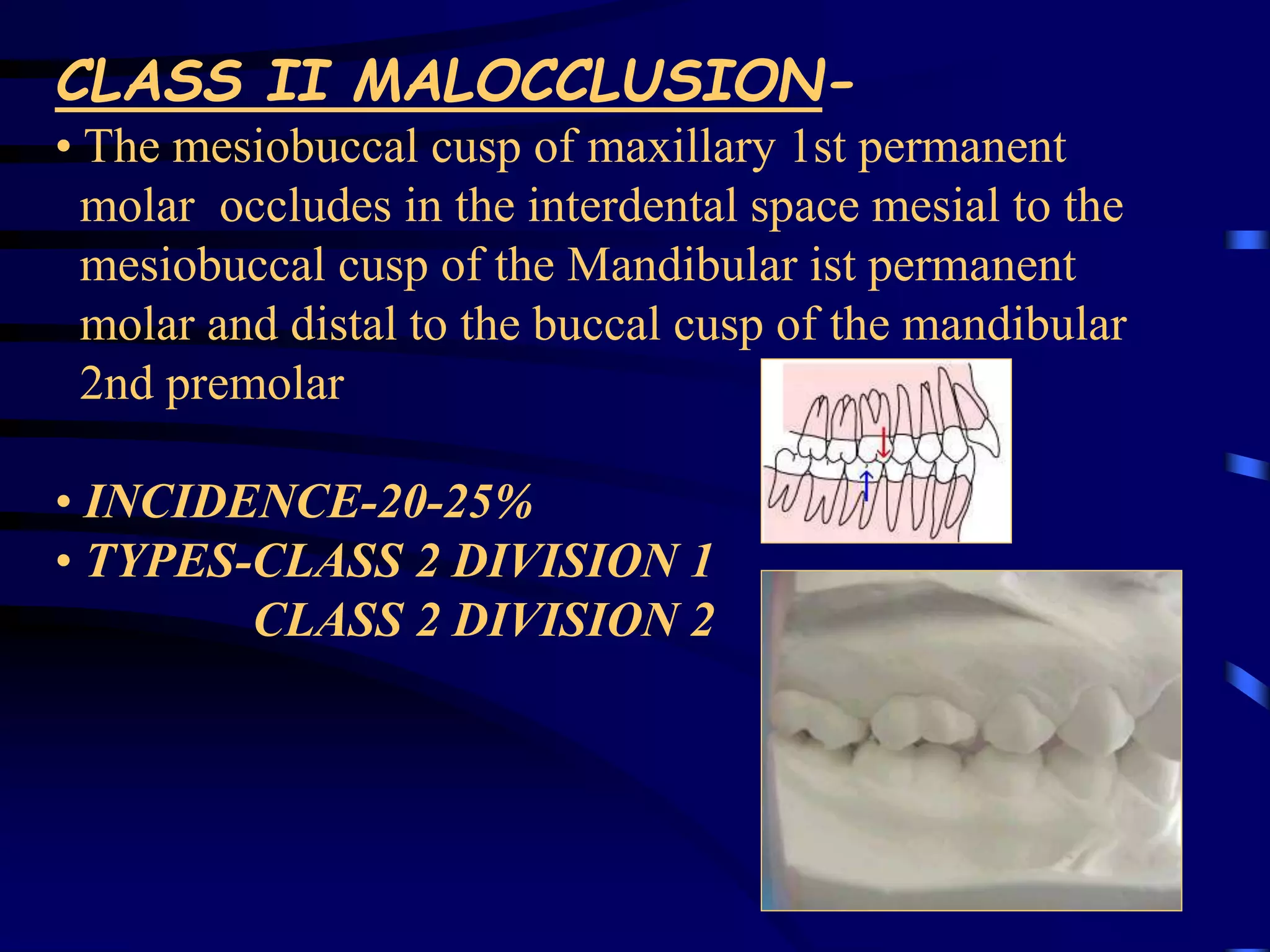 Treatment of class II | PPT