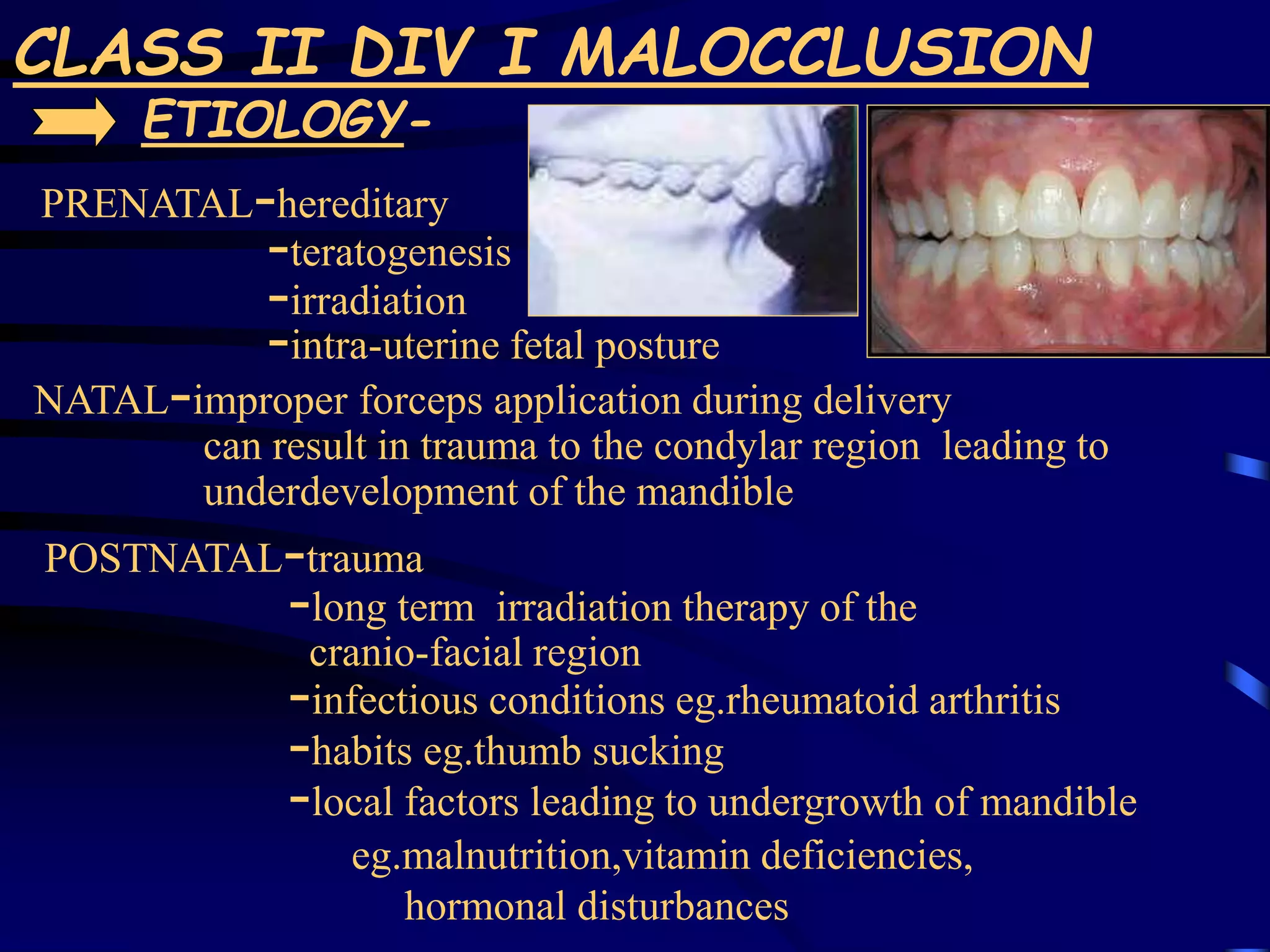 Treatment of class II | PPT